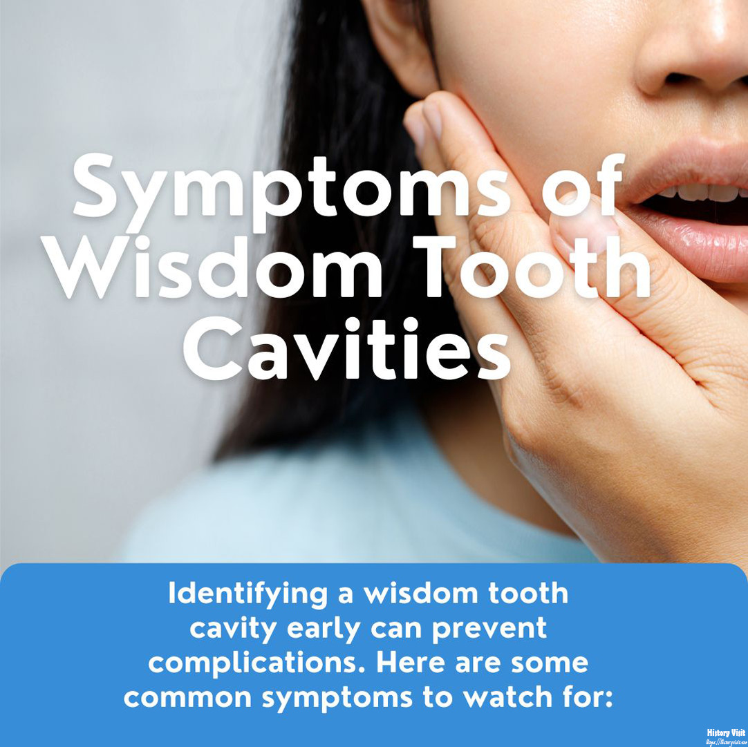 Wisdom Tooth Cavity: Hidden Dangers and Solutions - History Visit