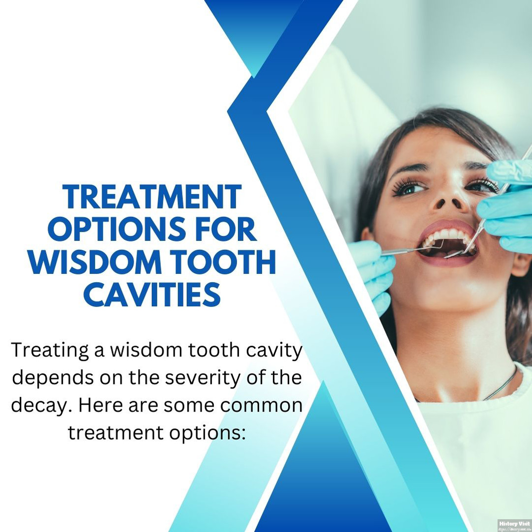 Wisdom Tooth Cavity: Hidden Dangers and Solutions - History Visit
